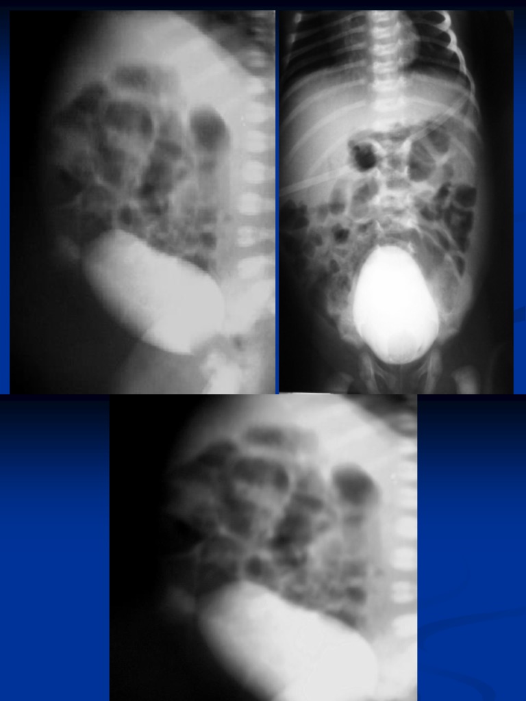 Anomalías del Uraco: Tipos y Síntomas | PDF | Ciencia y matemáticas