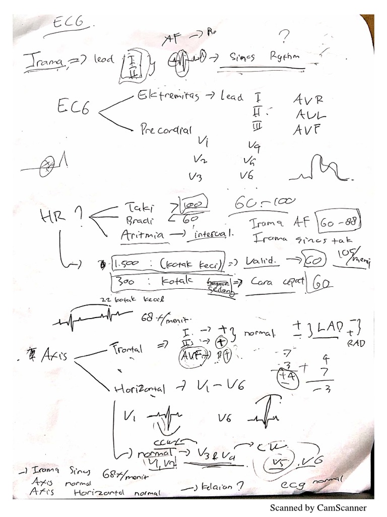 ECG (Mas Dio) | PDF