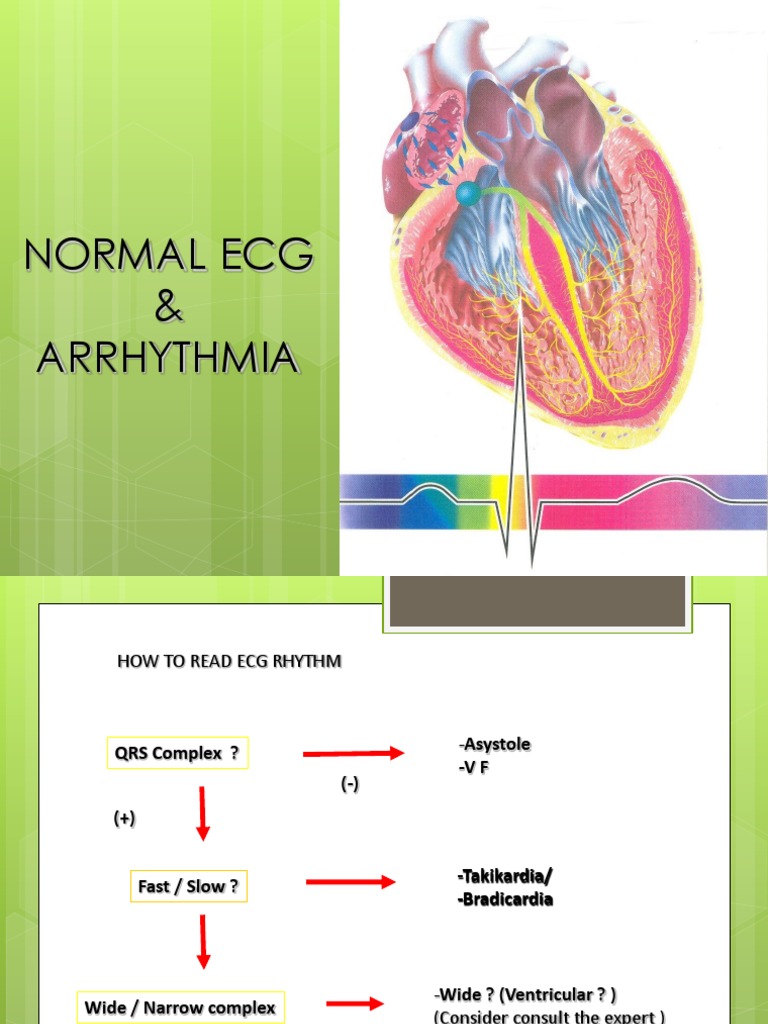 ECG Interpretation and Arrhythmias Guide | PDF