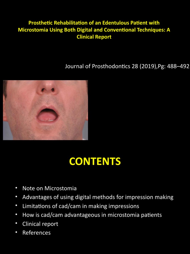 Prosthetic Rehabilitation of An Edentulous Patient With Microstomia ...