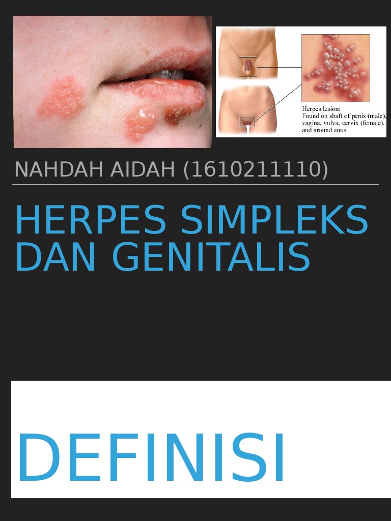 Herpes Simpleks Dan Genitals | PDF