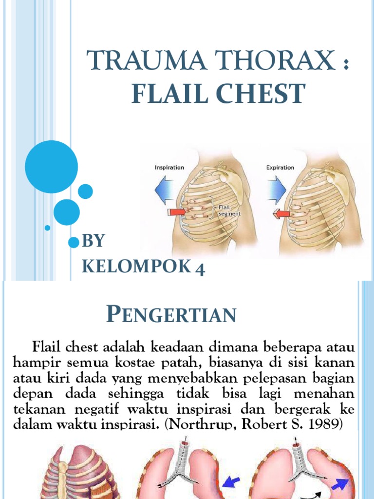 Flail Chest | PDF | Pengembangan Diri | Kesehatan Holistik