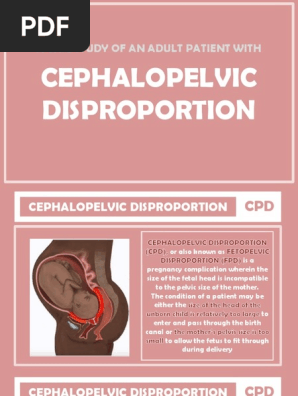 Cephalopelvic Disproportion Pathophysiology