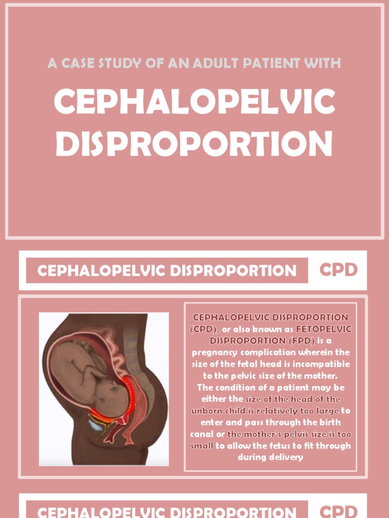 Cephalopelvic Disproportion | PDF | Childbirth | Gestational Diabetes Cephalopelvic Disproportion | PDF | Childbirth | Gestational Diabetes
