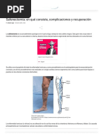 Cateter Subclavio Detallado | PDF | Embolia | Vena