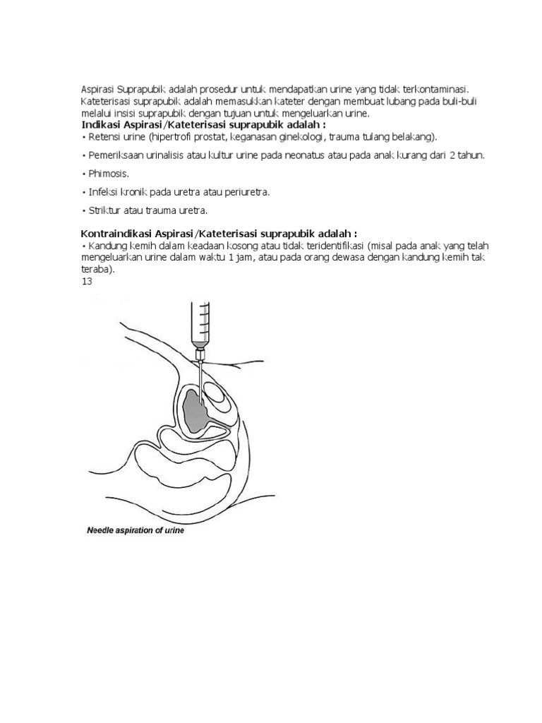 Prosedur Aspirasi Suprapubik Urine | PDF