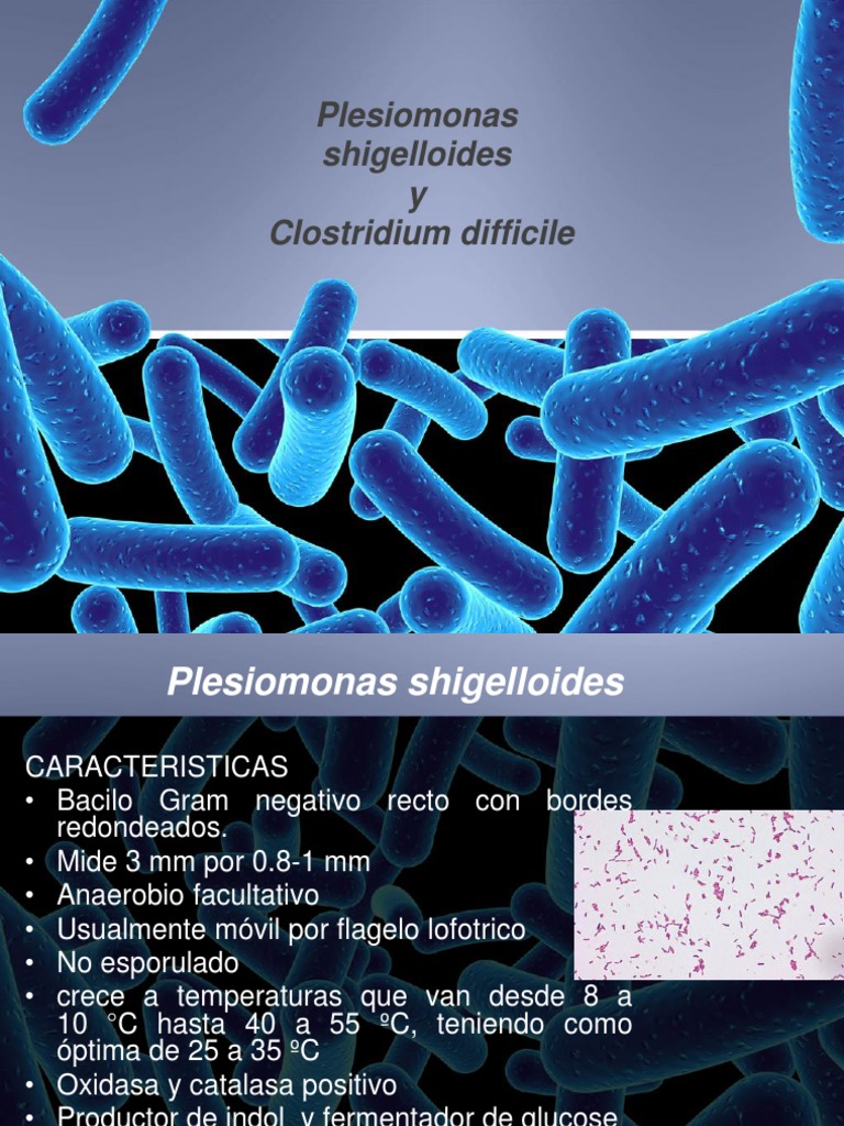 8-Plesiomonas Shigelloides y Clostridium Difficile | PDF | Diarrea ...