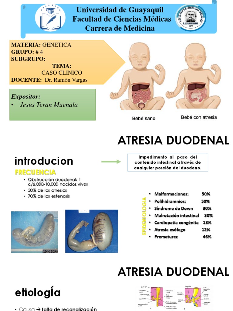 Atresia Duodenal | PDF | Estómago | Abdomen
