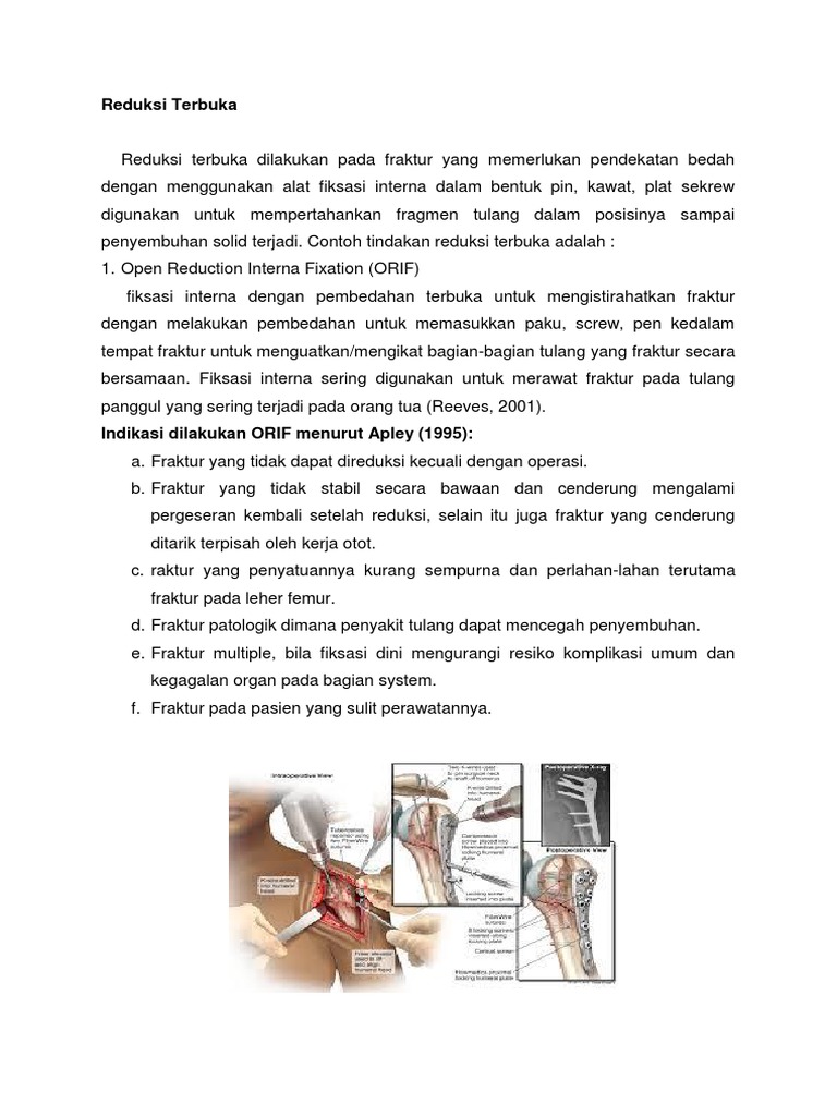 Reduksi Terbuka | PDF
