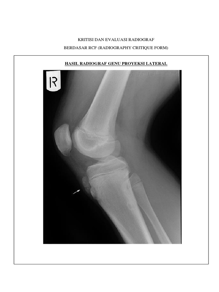Kritisi Dan Evaluasi Radiograf | PDF | Sains & Matematika