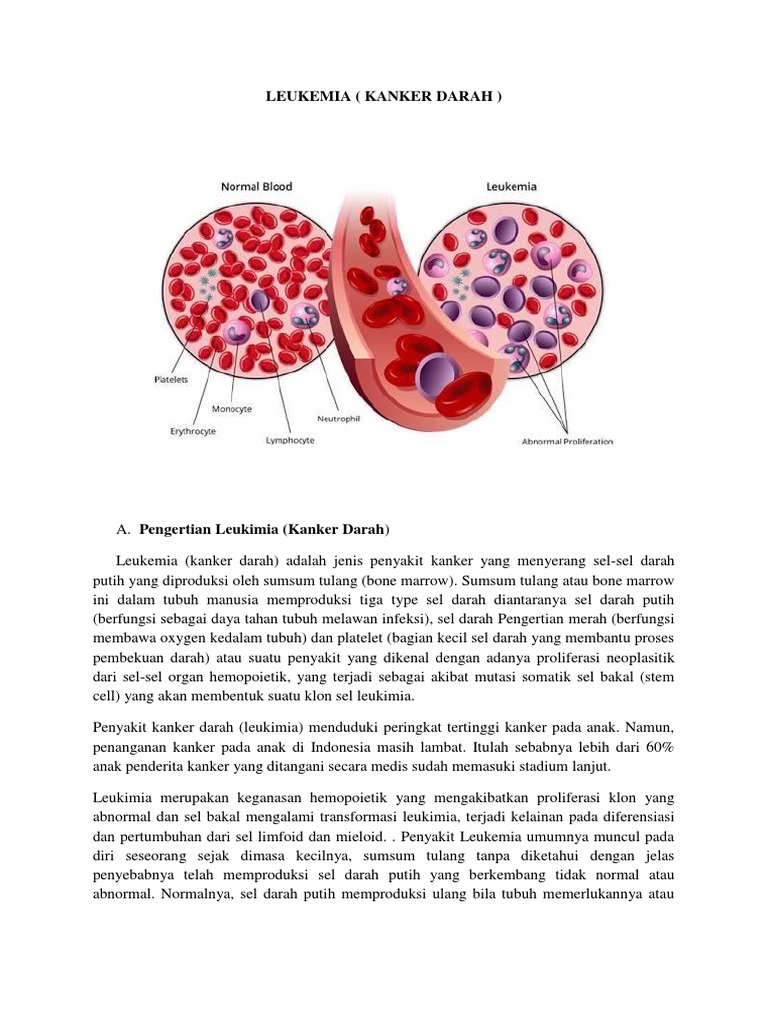Ciri dan Penyebab Leukimia Anak | PDF | Pengembangan Diri | Kesehatan ...