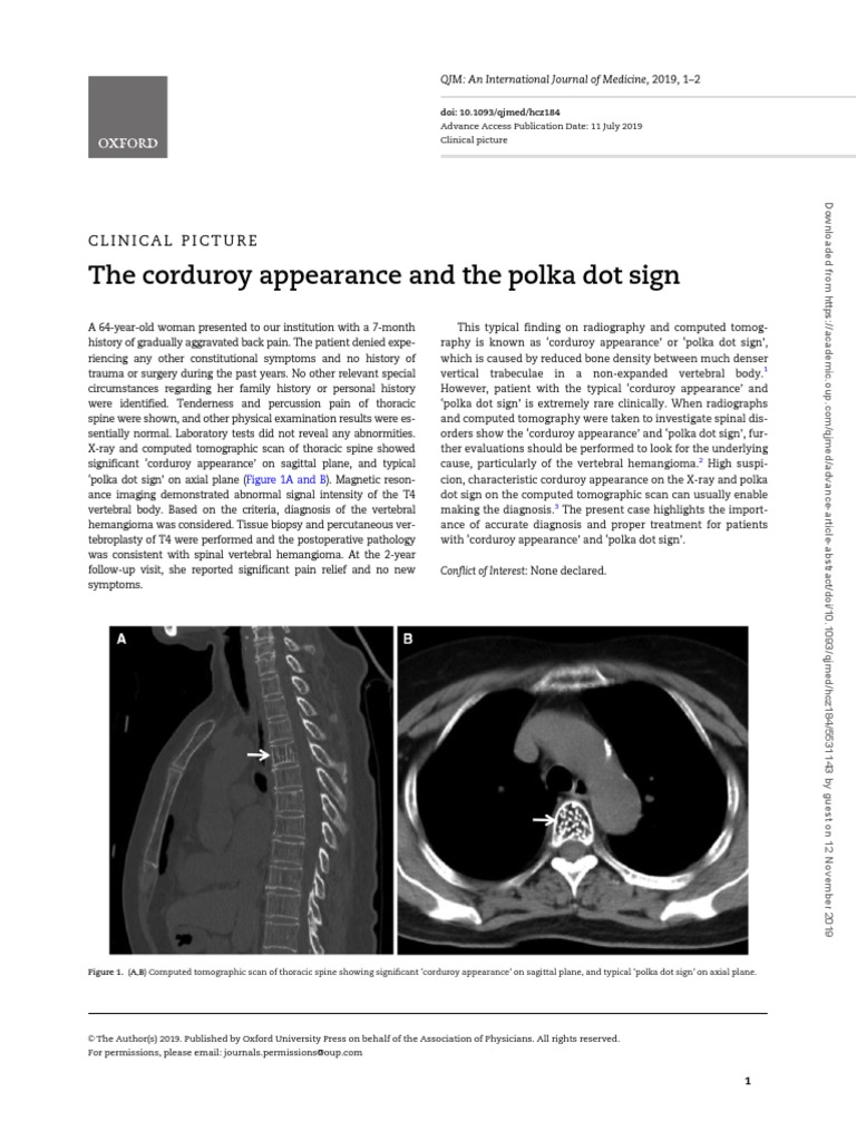 The Corduroy Appearance and The Polka Dot Sign: Clinicalpicture | PDF ...
