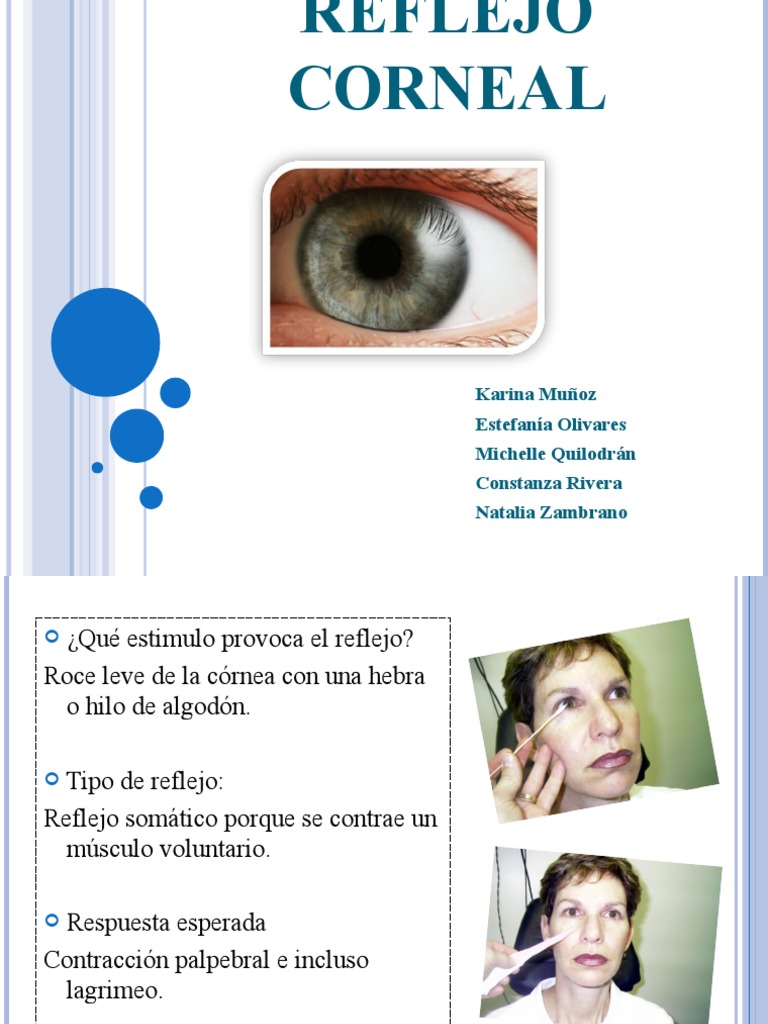 Reflejo Corneal 2 | PDF