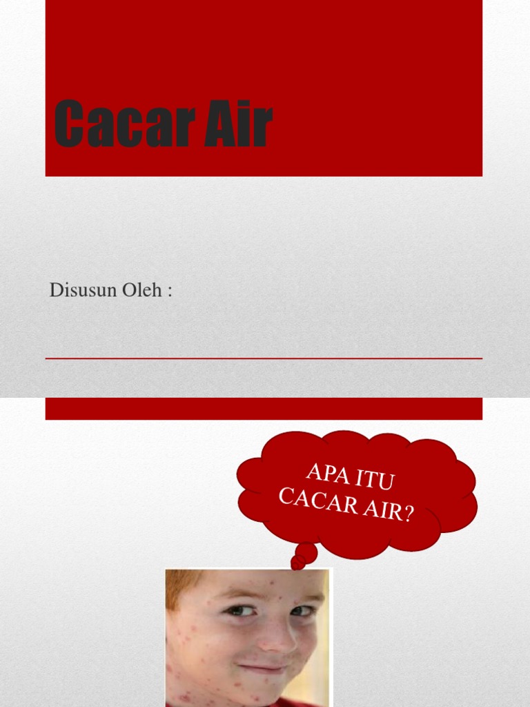 Cacar Air | PDF