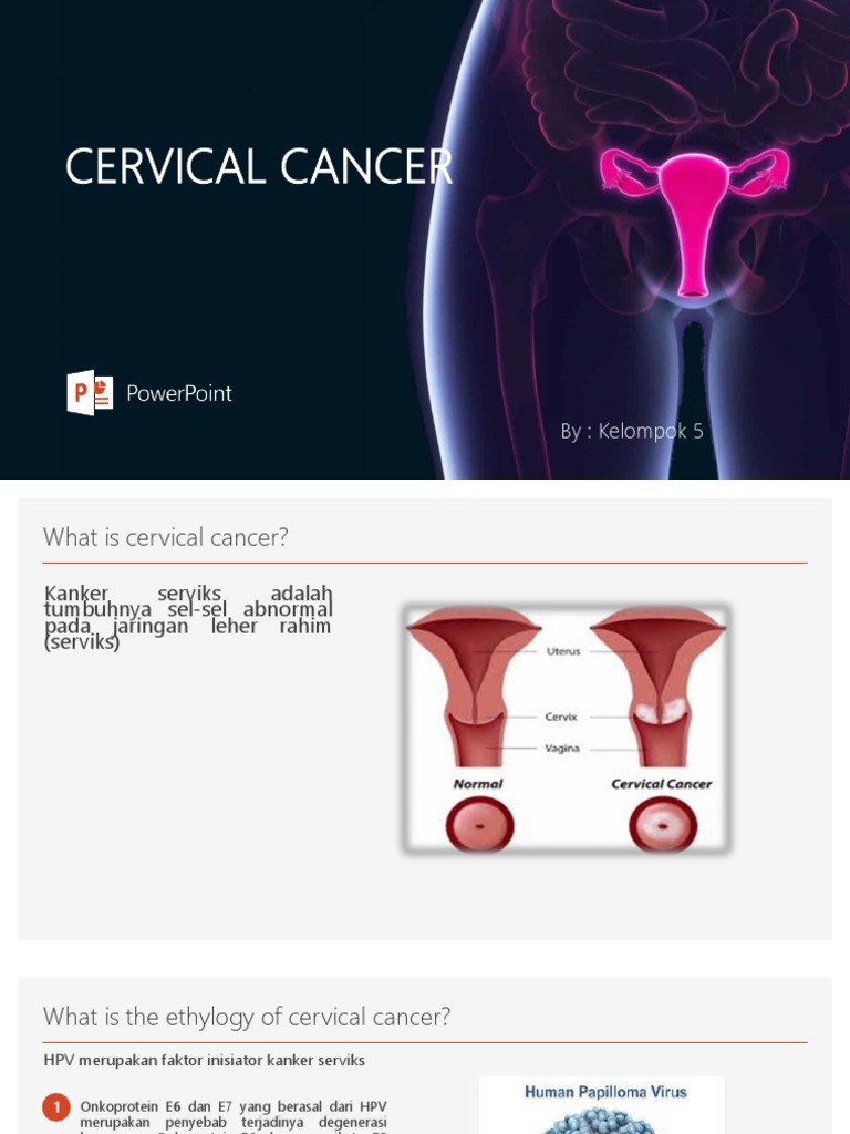 Cervical Cancer | PDF