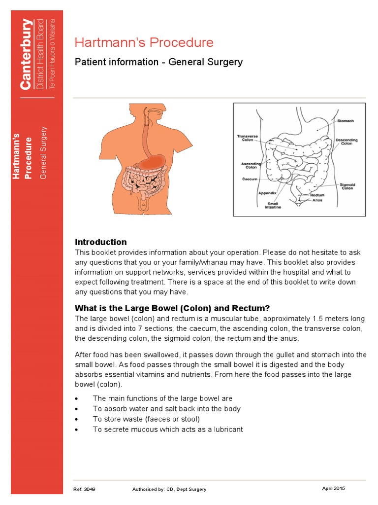 Hartmann's Procedure: Patient Information - General Surgery | PDF ...