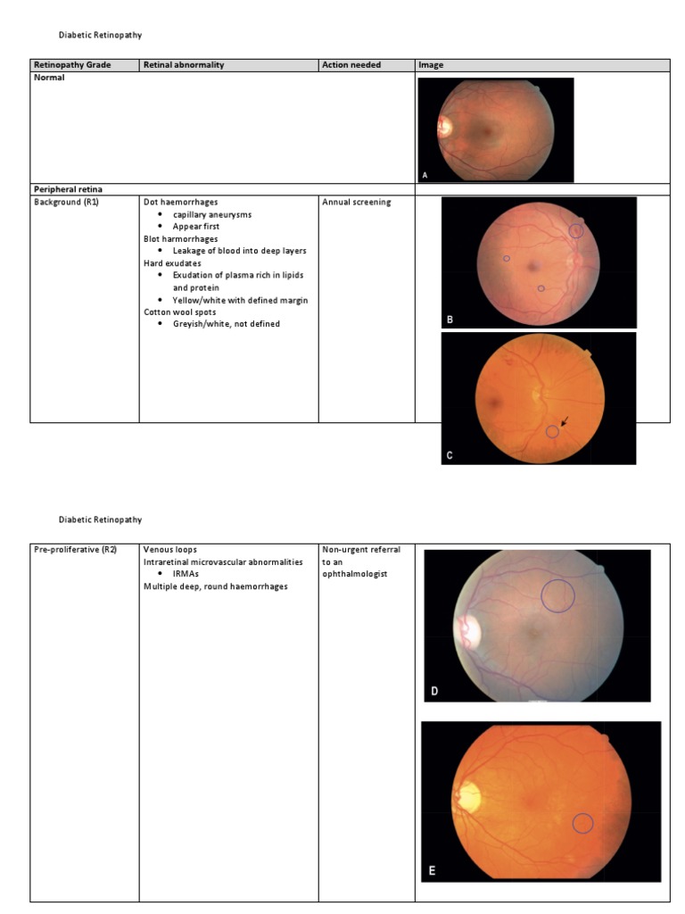 Retinopathy Grade Retinal Abnormality Action Needed Image Normal | PDF ...