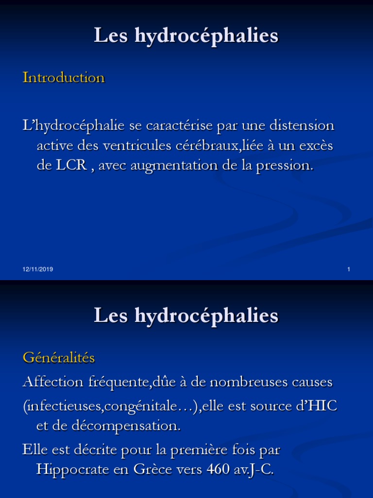 Hydrocéphalie Triventriculaire : Causes et Traitement | PDF | Liquide cérébro-spinal | Neurologie