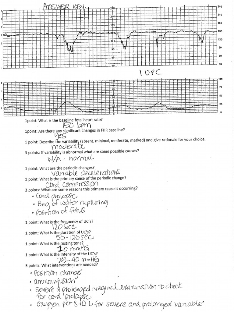 Fetal monitoring strip example key