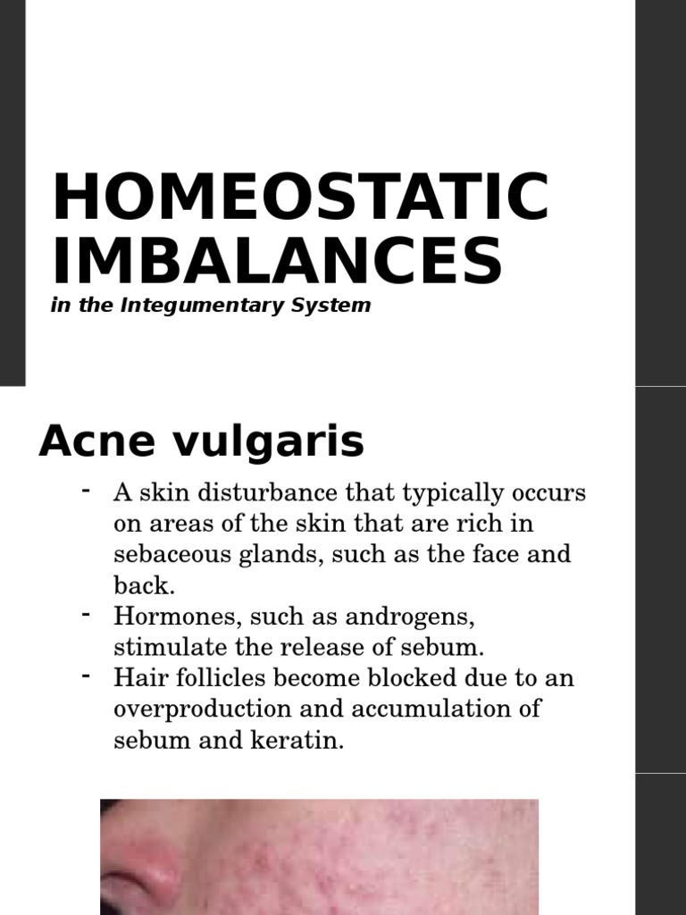 Homeostatic Imbalances: in The Integumentary System | PDF | Hair Loss ...