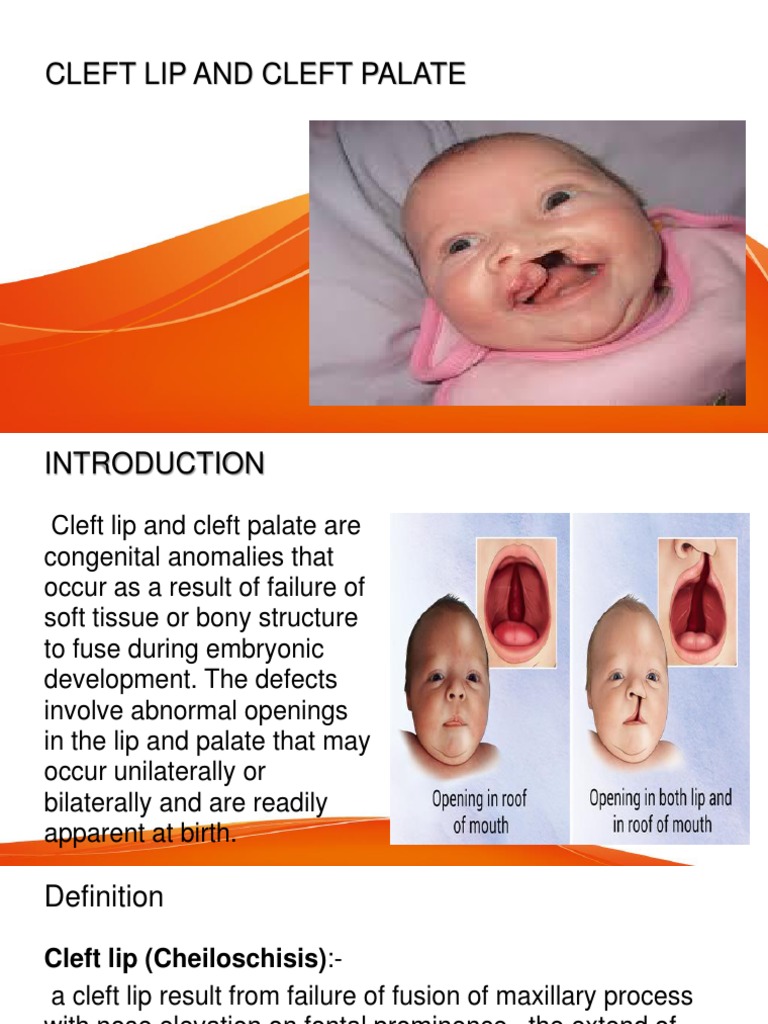 Cleft Lip and Cleft Palate | PDF | Medicine | Health Sciences