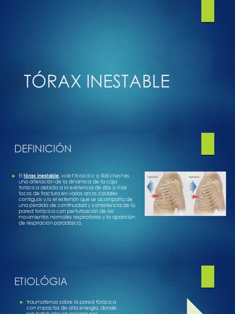 Tórax Inestable | PDF | Tórax | Sistema respiratorio
