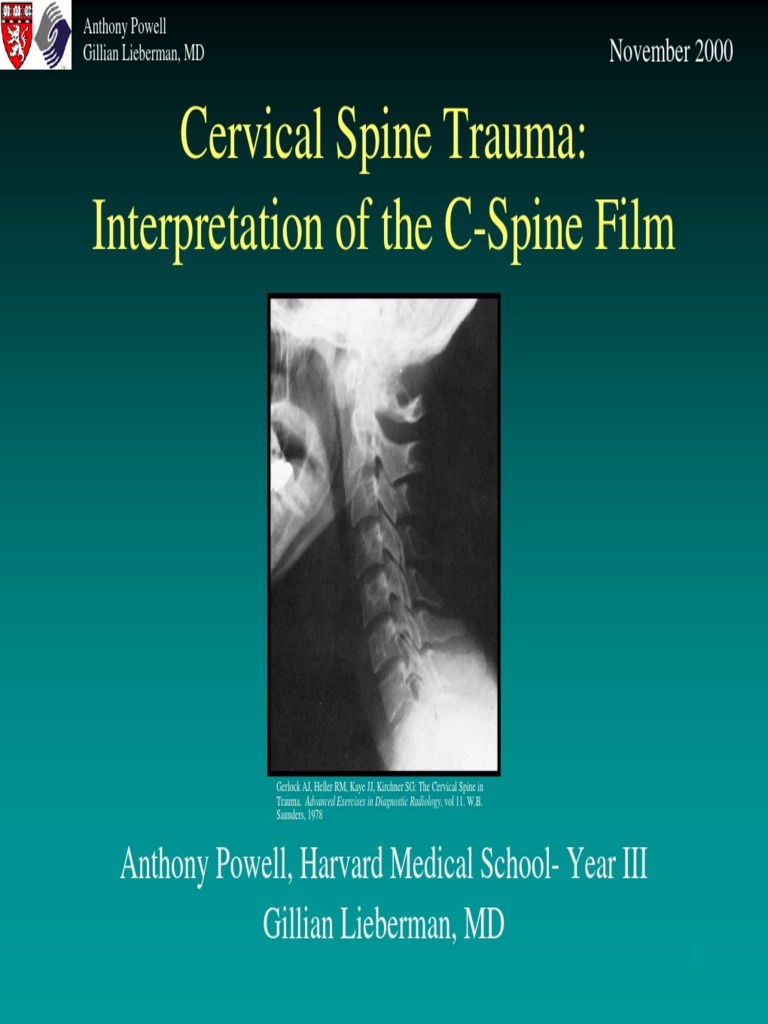 Cervical Radio | PDF | Vertebra | Vertebral Column