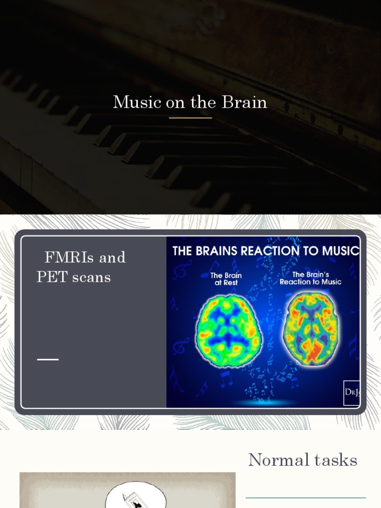 Music On The Brain | PDF
