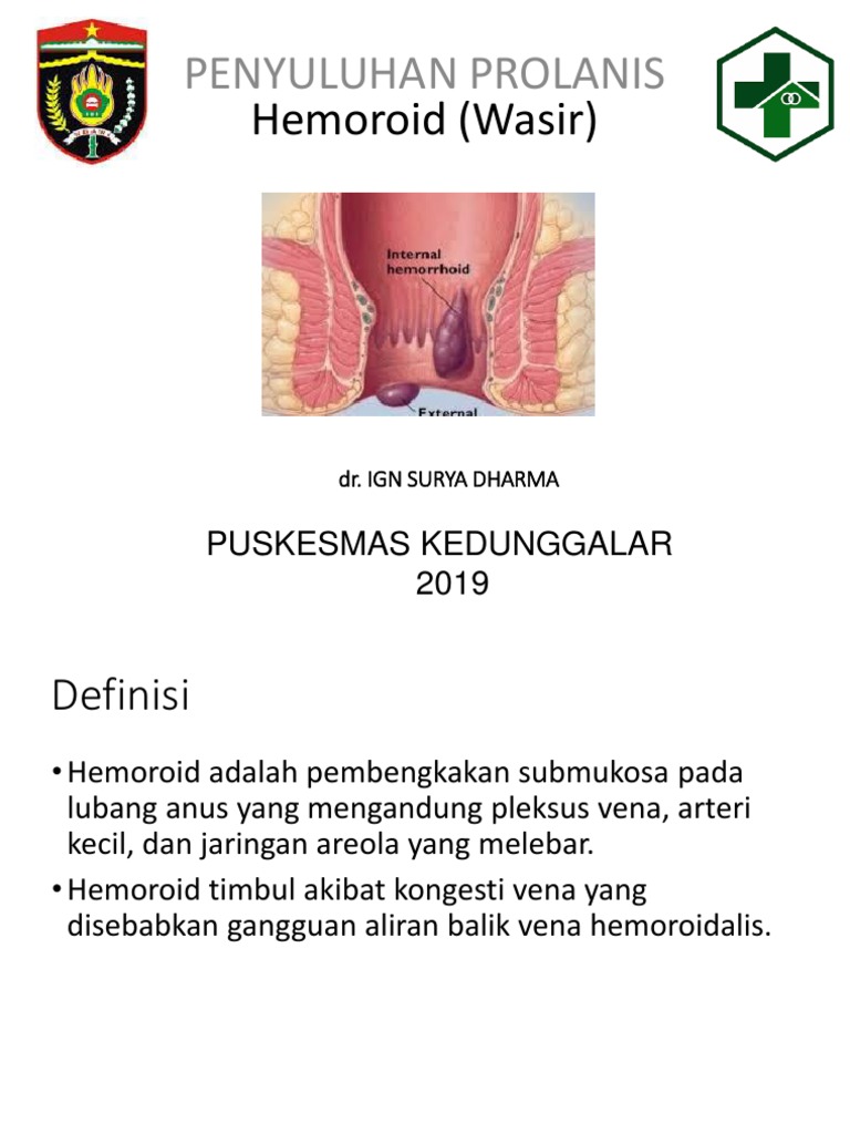 Hemoroid | PDF | Sains & Matematika