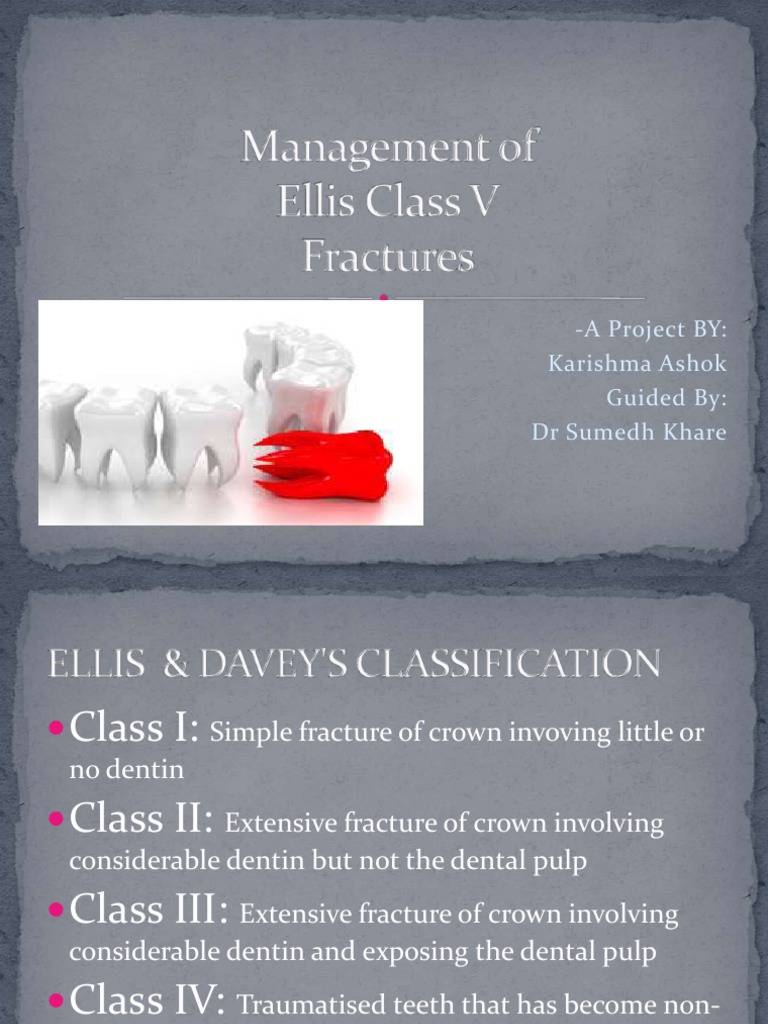 Ellis Fractures | PDF | Human Tooth | Healing