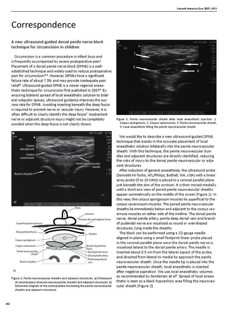 Correspondence: A New Ultrasound-Guided Dorsal Penile Nerve Block ...