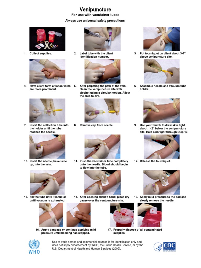 Venipuncture PDF | PDF