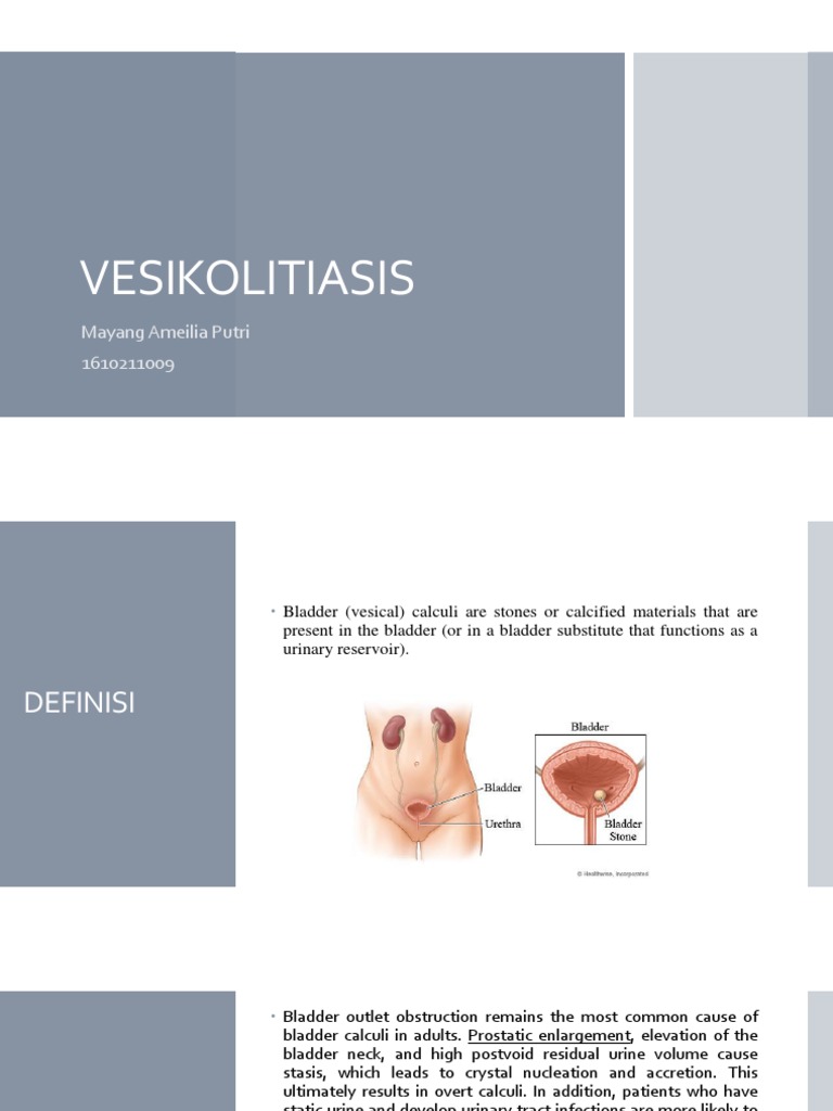 Vesikolitiasis Map 6 | PDF | Urology | Medical Specialties