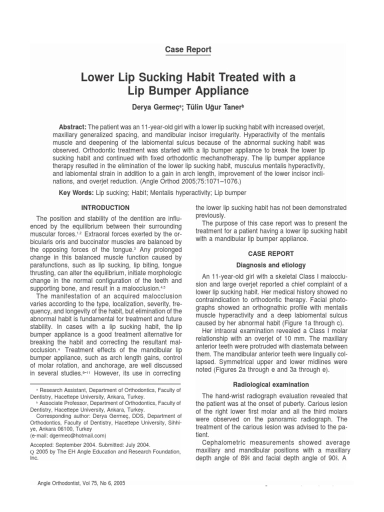 Case Report Lip Bumper | PDF | Orthodontics | Mouth