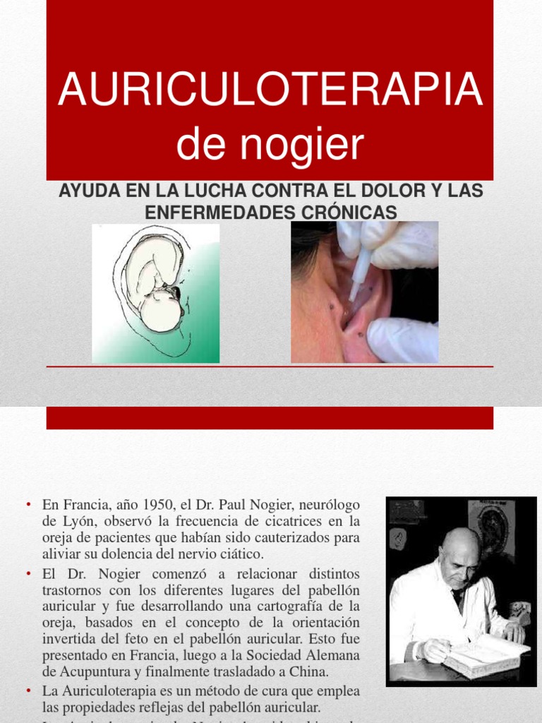 Auriculoterapia de Nogier | PDF | Medicina CLINICA | Especialidades Medicas