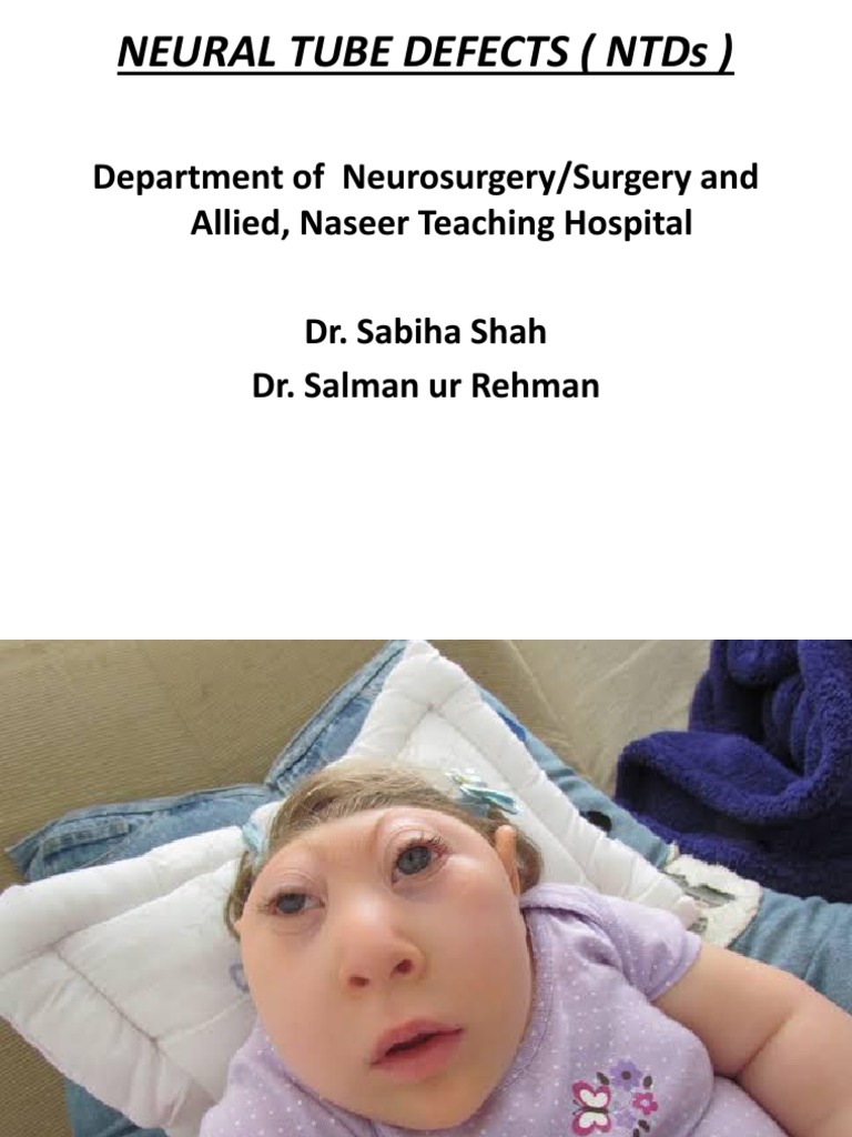 Neural Tube Defects (NTDS) | PDF | Nervous System | Pregnancy