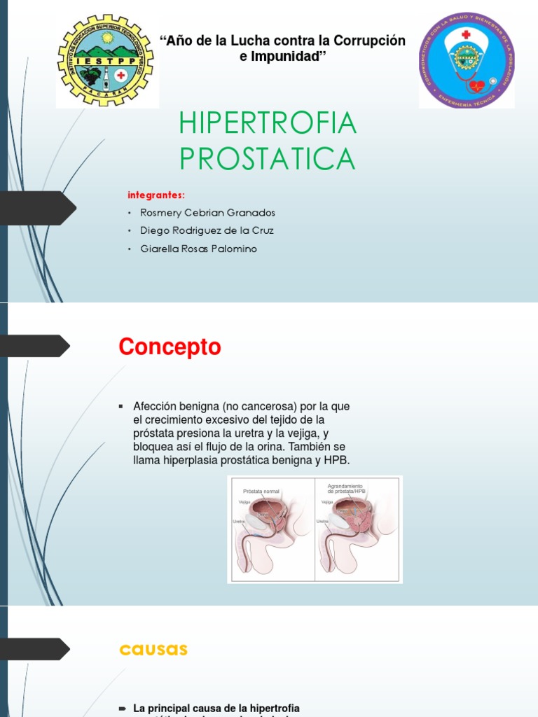Hipertrofia Prostática: Síntomas y Tratamientos | PDF | Cancer de ...
