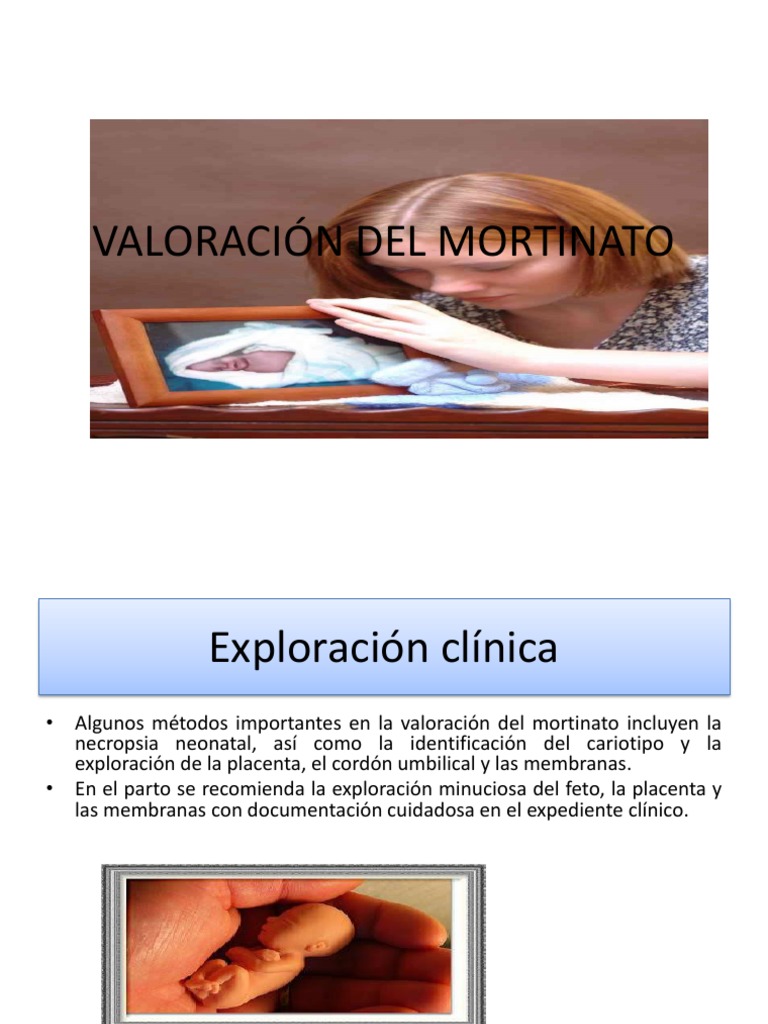 Valoración Del Mortinato | PDF