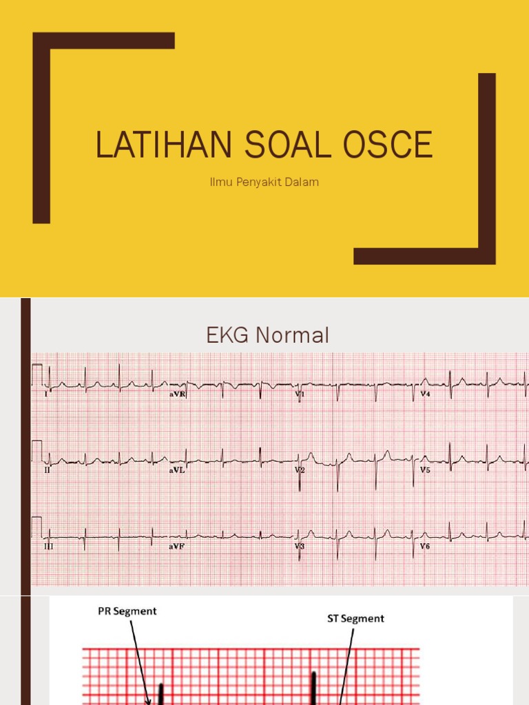 Latihan EKG | PDF