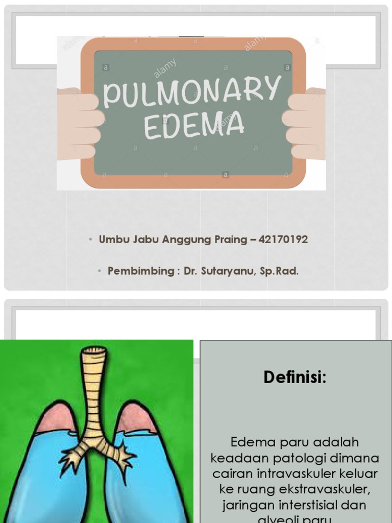 Gejala dan Penyebab Edema Paru | PDF