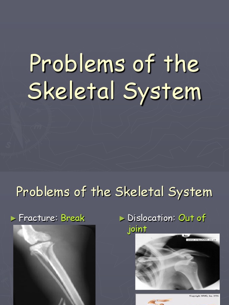 Problems of The Skeletal System | PDF | Bone | Joint