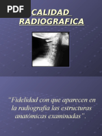 Pitch y TC Helicoidal | PDF | Ct Scan