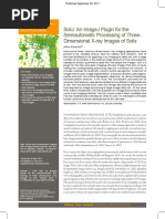 Numerical Analysis of Forepole in Tunnelling | PDF | Computer ...