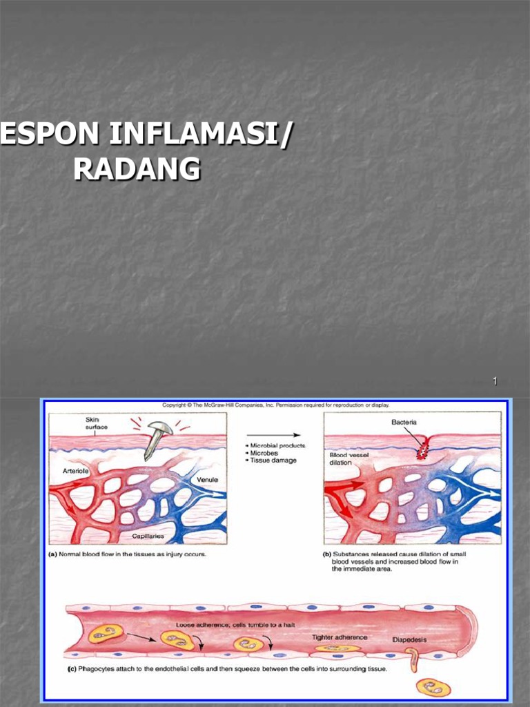 Respon Inflamasi-Radang OK | PDF