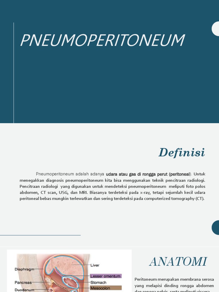 PNEUMOPERITONEUM | PDF