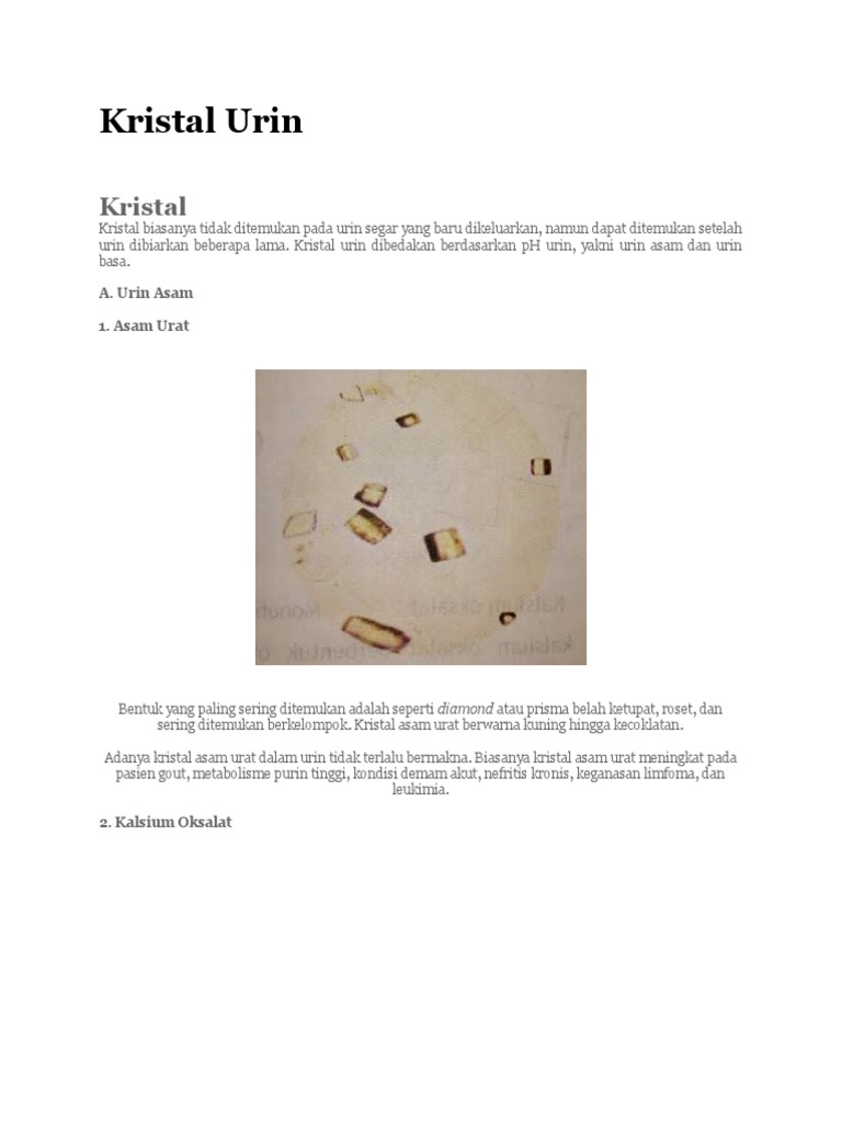 Kristal Urin | PDF