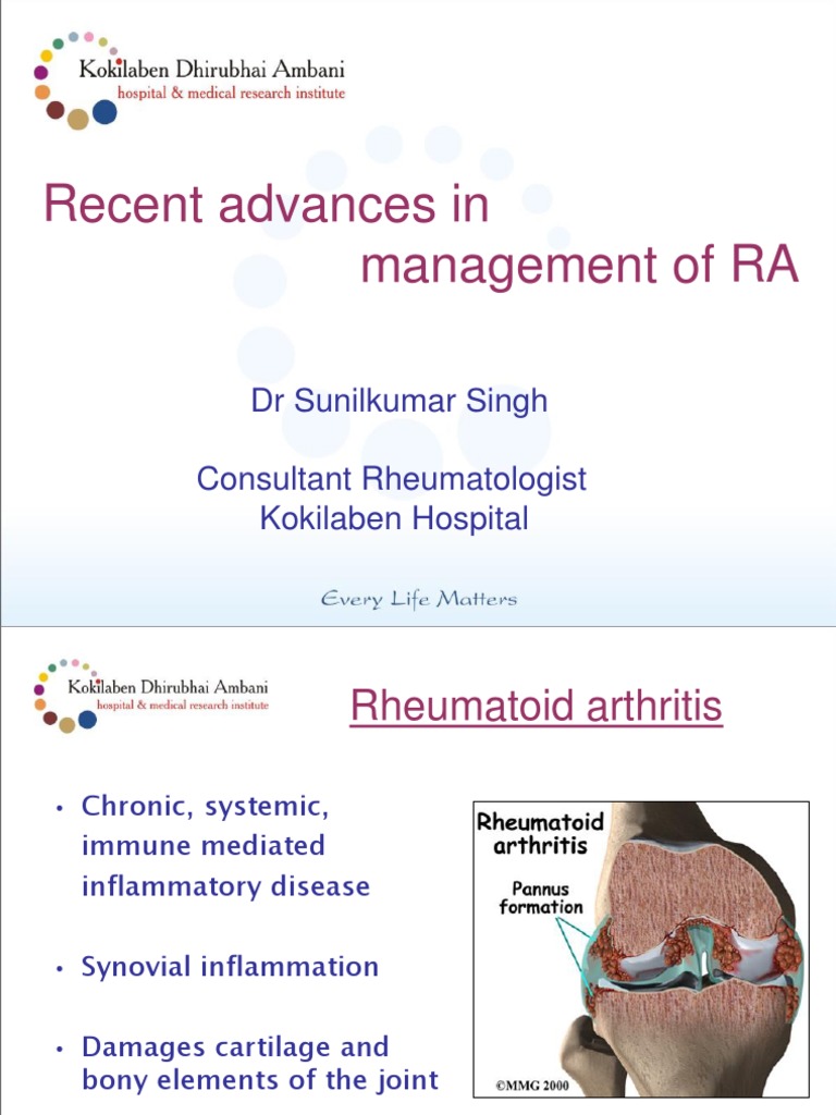Recent Advances in Management of RA: DR Sunilkumar Singh Consultant ...