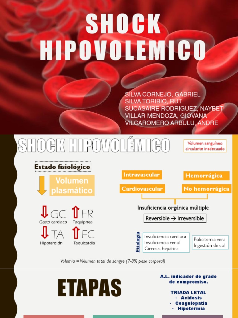 Shock Hipovolemico | PDF | Especialidades Medicas | Medicina CLINICA