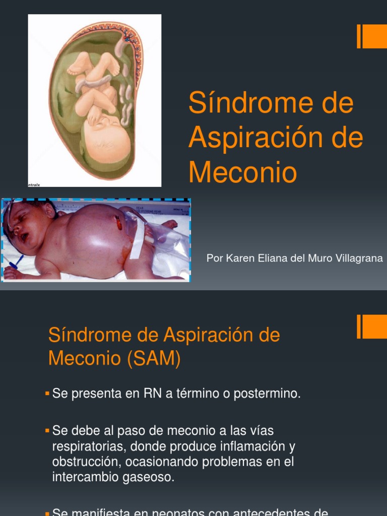 Síndrome de Aspiración de Meconio en RN | PDF | Pulmón | Inflamación