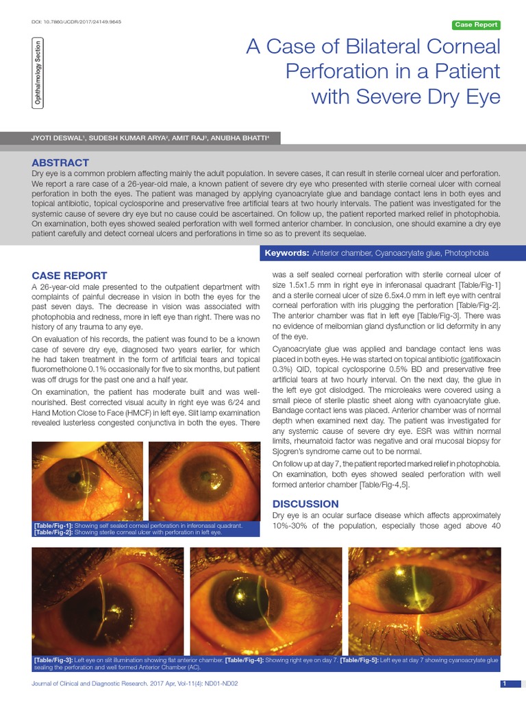 Bilateral Corneal Perforation in Severe Dry Eye | PDF | Cornea | Visual ...